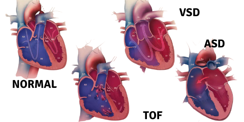 Heart Disease:What are the most Common symptoms – HealthNactive